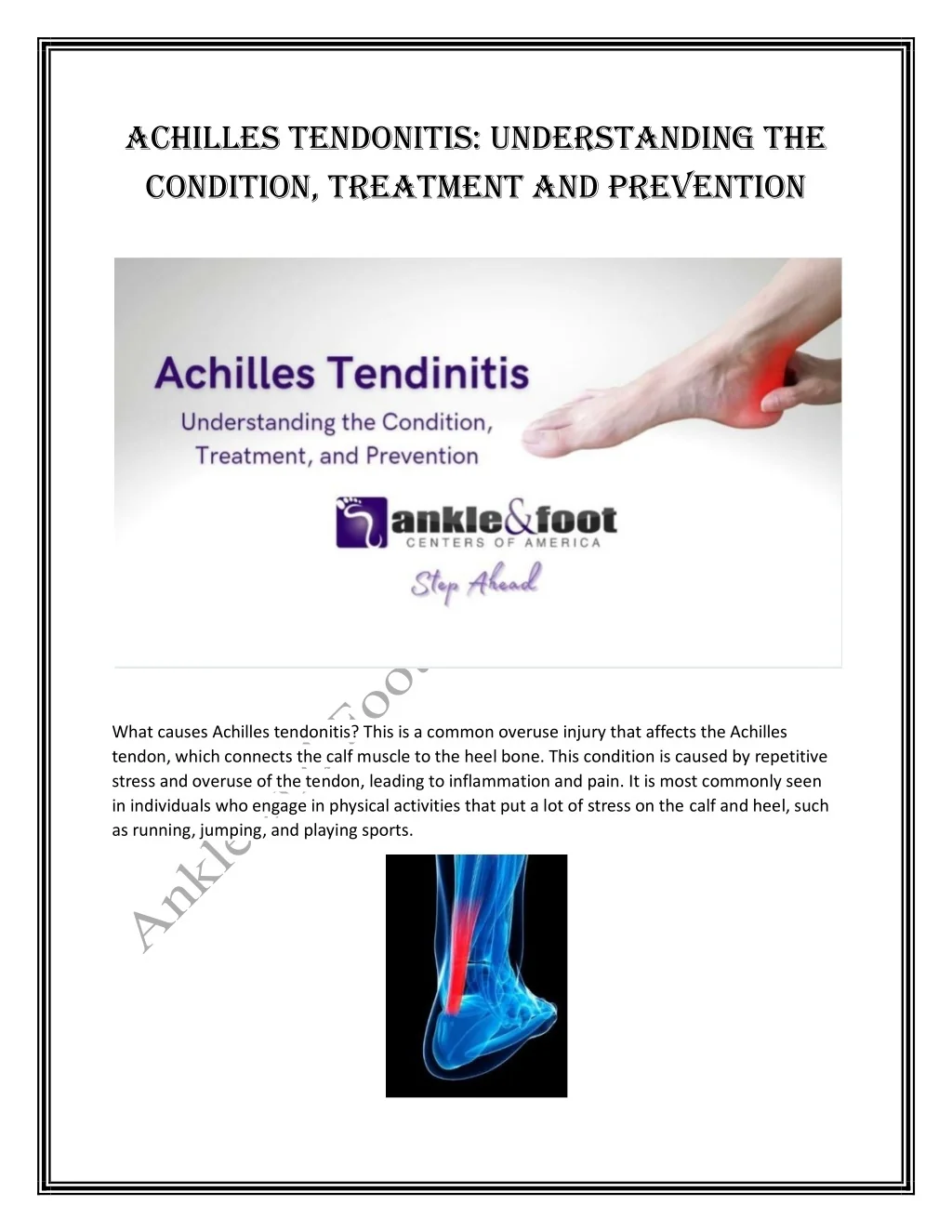 PPT - Achilles Tendonitis: Understanding the Condition, Treatment and ...
