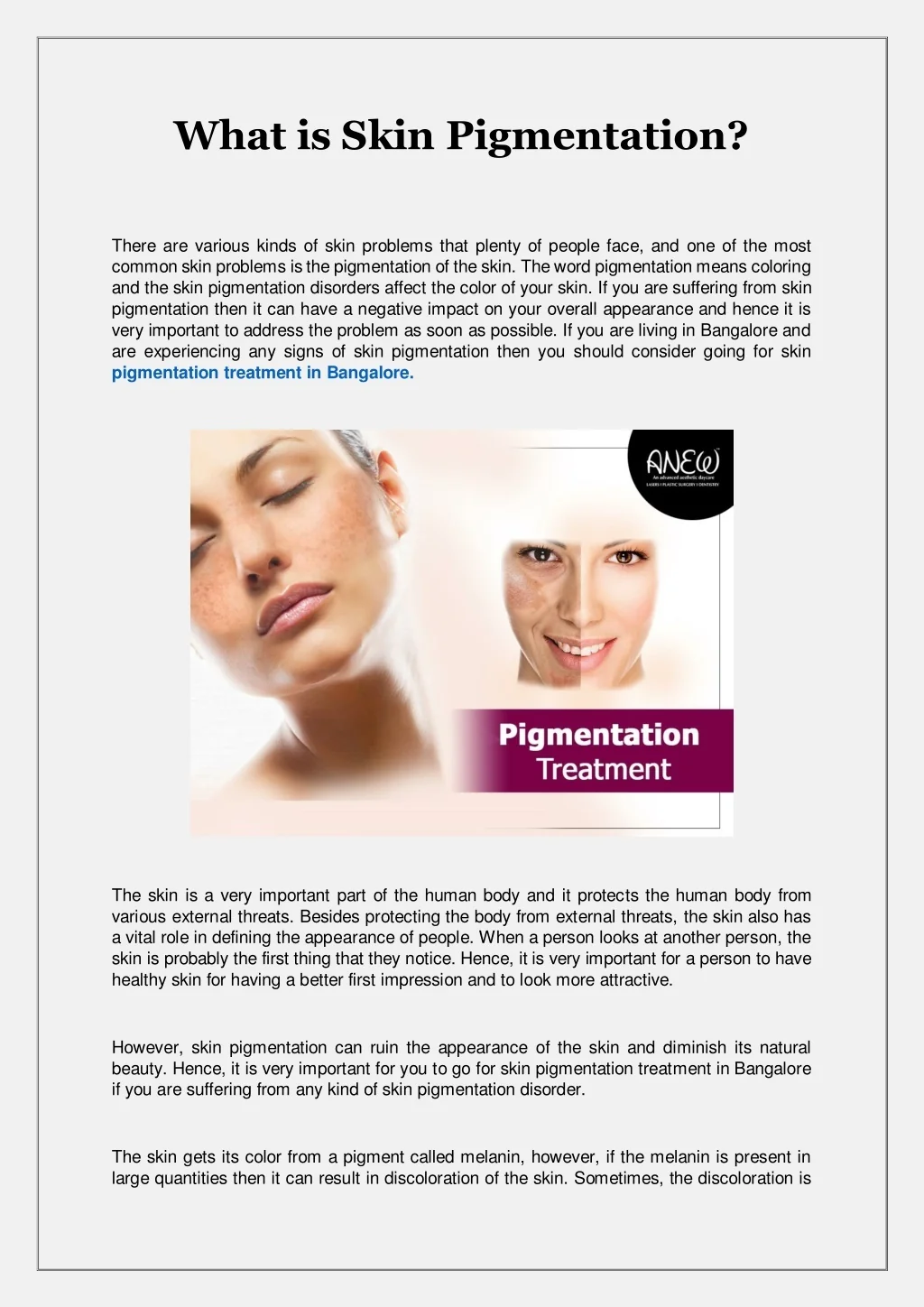 PPT - What is Skin Pigmentation? PowerPoint Presentation, free download ...