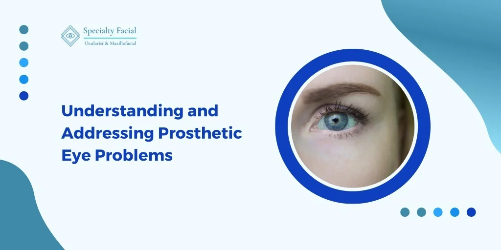 PPT - Understanding and Addressing Prosthetic Eye Problems PowerPoint ...