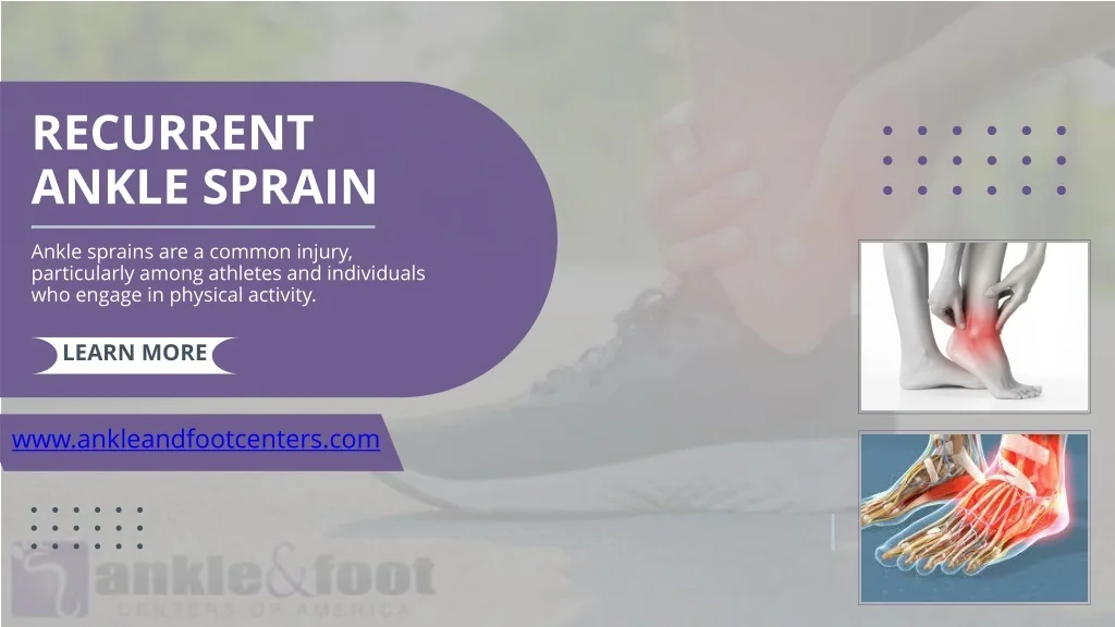 PPT - Recurrent Ankle Sprain- Ankle and Foot Centers of America PowerPoint Presentation - ID ...