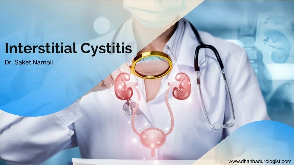 PPT - A Comprehensive Guide To Interstitial Cystitis PowerPoint Presentation - ID:12258309