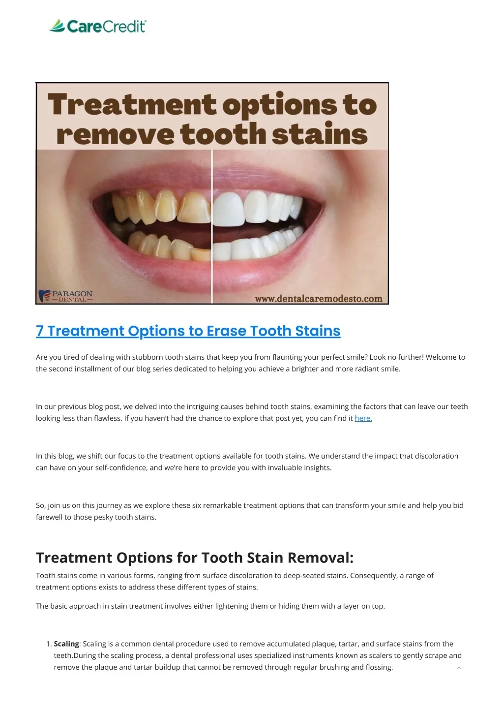 PPT - 7 Treatment options for tooth stains PowerPoint Presentation ...