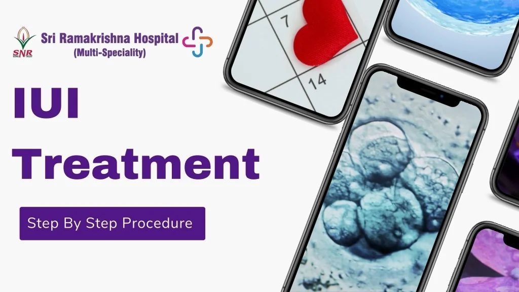 PPT - IUI treatment Step By Step Procedure PowerPoint Presentation ...