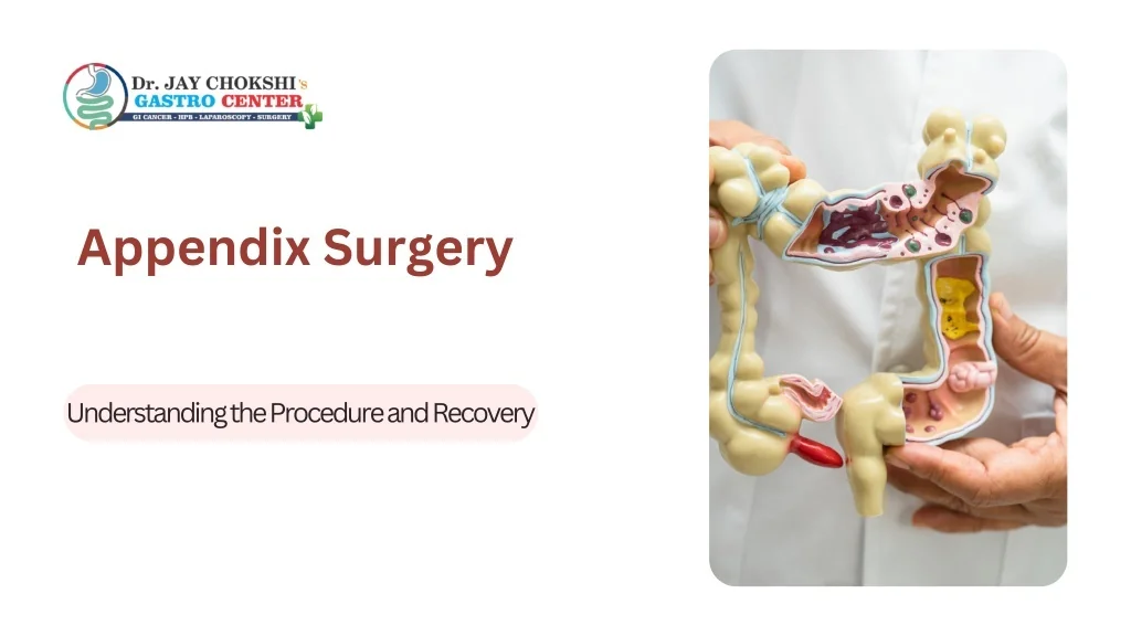 PPT - Information about Appendix Surgery PowerPoint Presentation, free ...