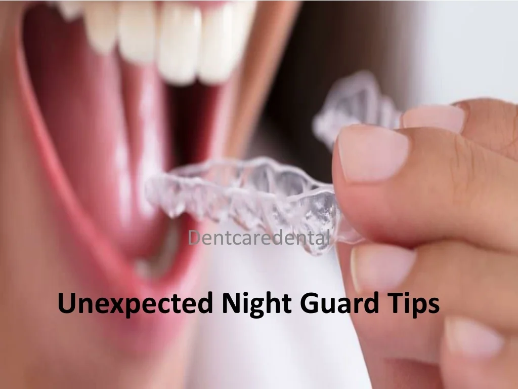 PPT - Unexpected Night Guard Tips PowerPoint Presentation, free ...