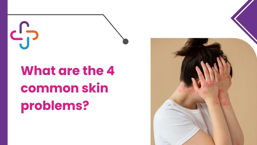 PPT - What are the 4 common skin problems PowerPoint Presentation, free ...