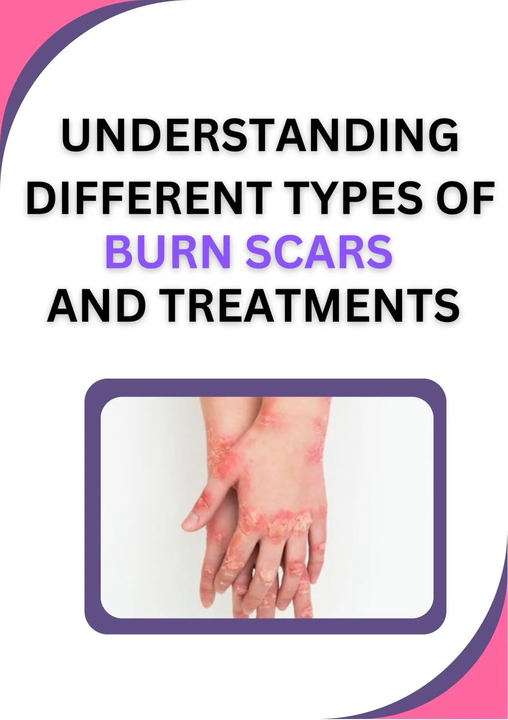 PPT - Understanding the Different Types of Burn Scars and Their ...
