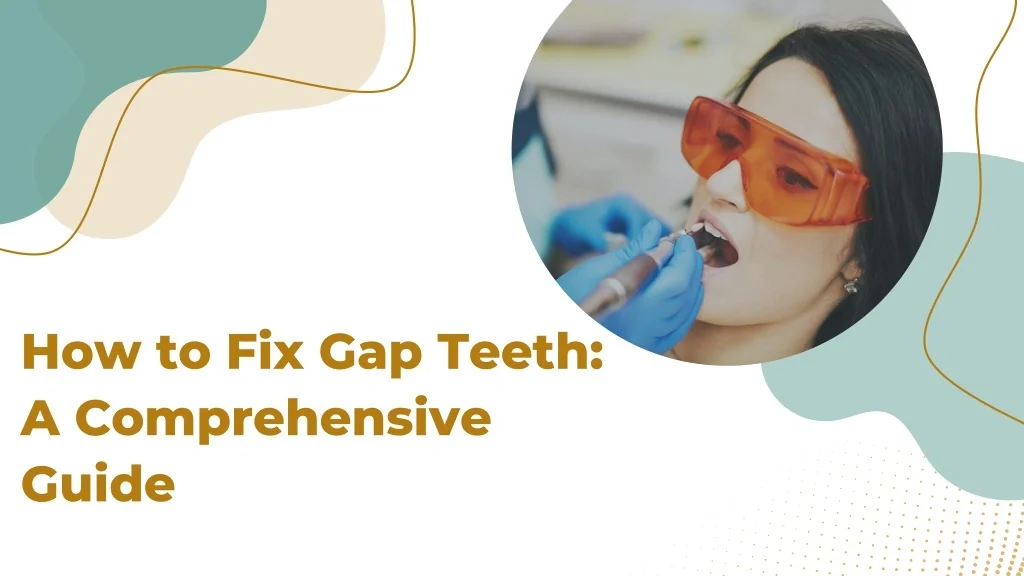PPT - How to Fix Gap Teeth- A Comprehensive Guide PowerPoint ...