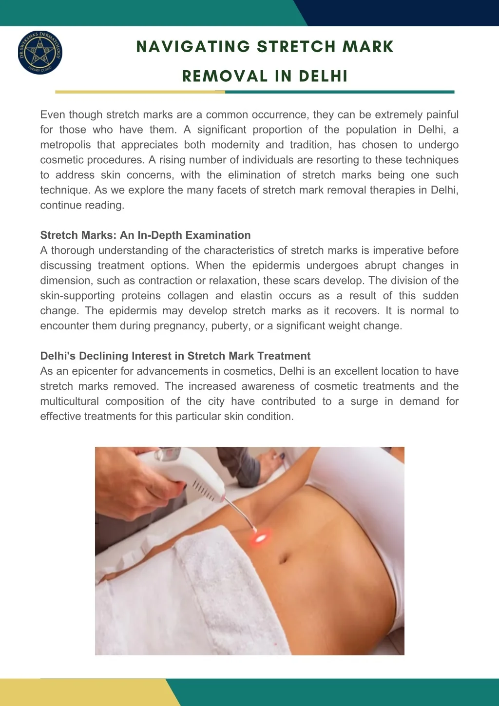 PPT - Navigating Stretch Mark Removal in Delhi PowerPoint Presentation ...