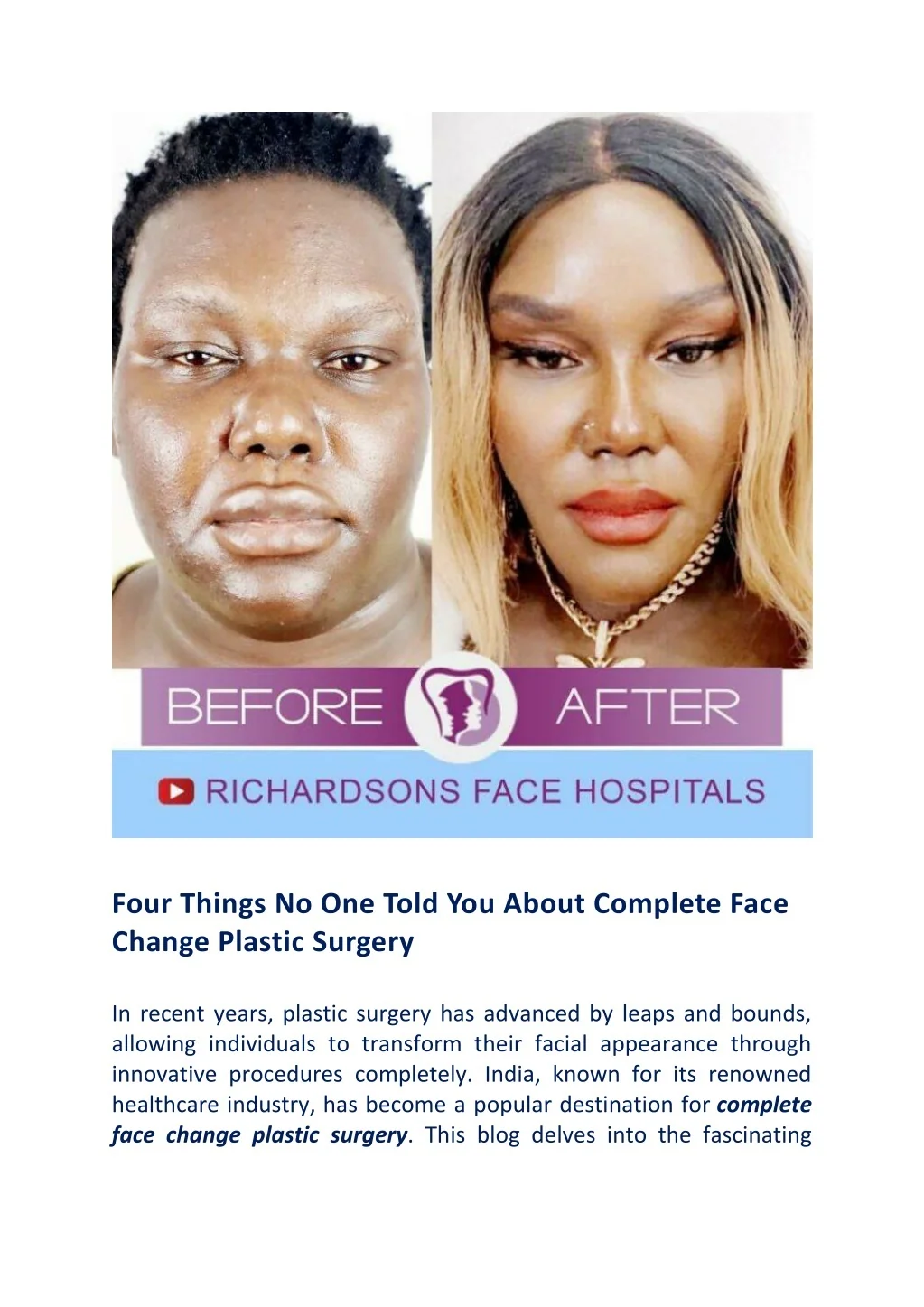 PPT - All That You Must Know About Complete Face Change Plastic Surgery ...