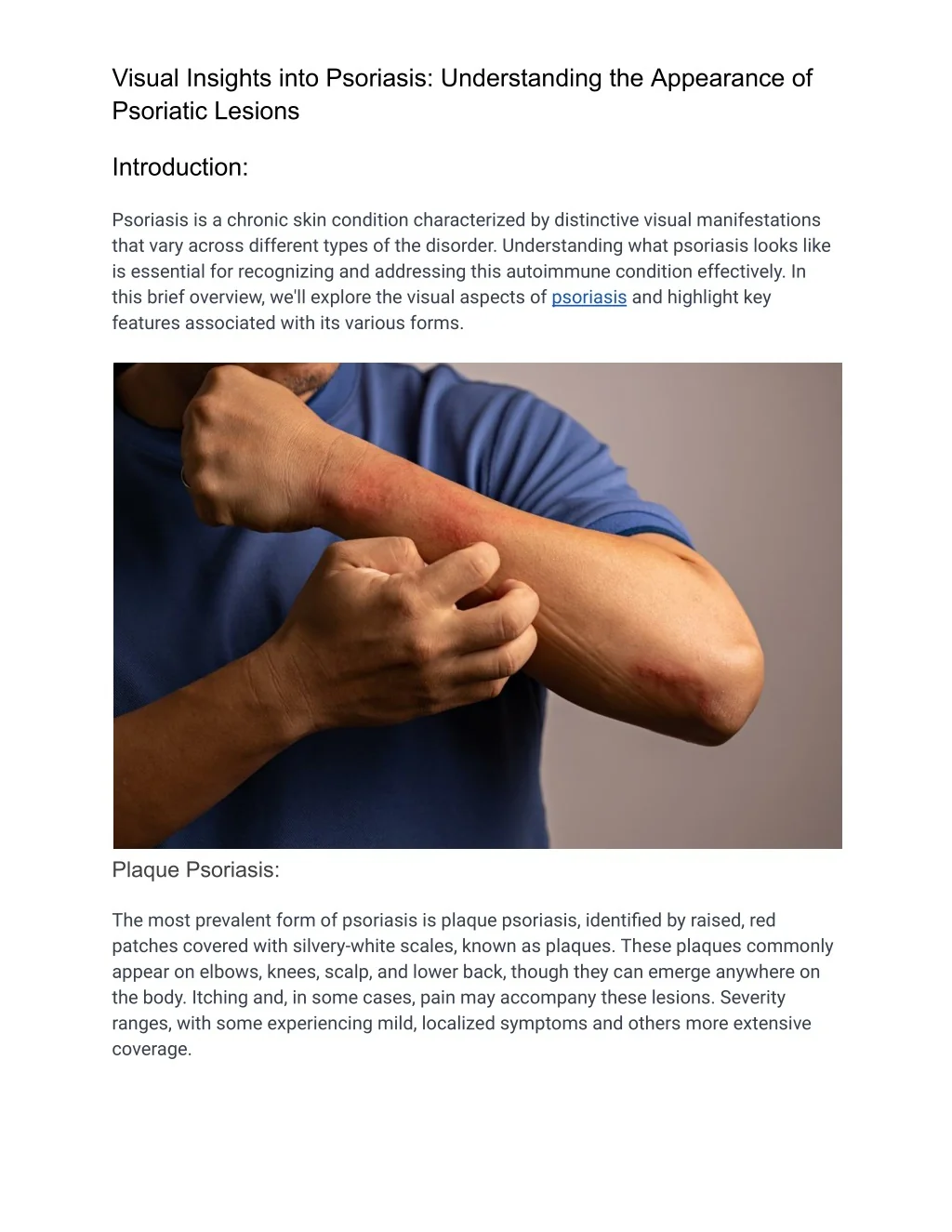 PPT - What Psoriasis Looks Like PowerPoint Presentation, free download ...