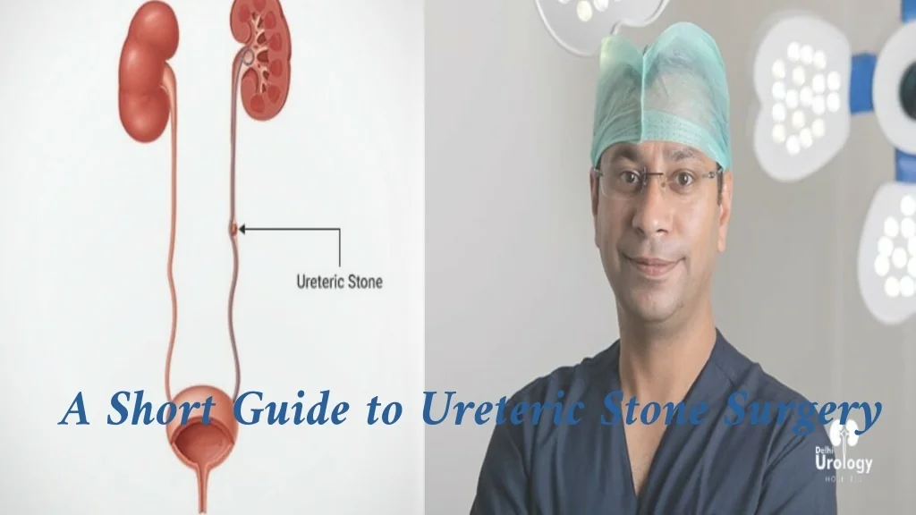 PPT - A Short Guide to Ureteric Stone Surgery PowerPoint Presentation ...