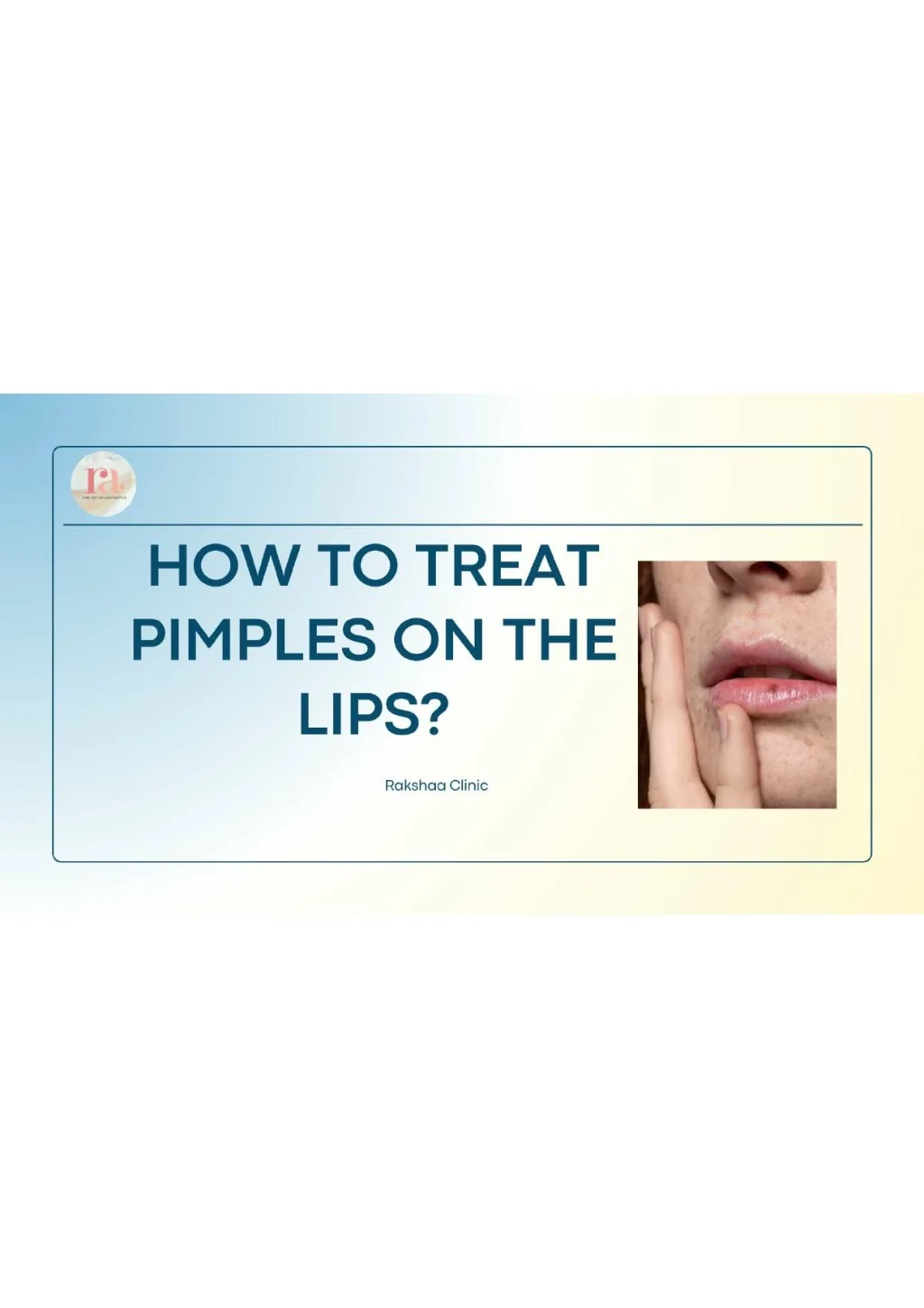 PPT - How to Treat Pimples on the Lips PowerPoint Presentation, free ...