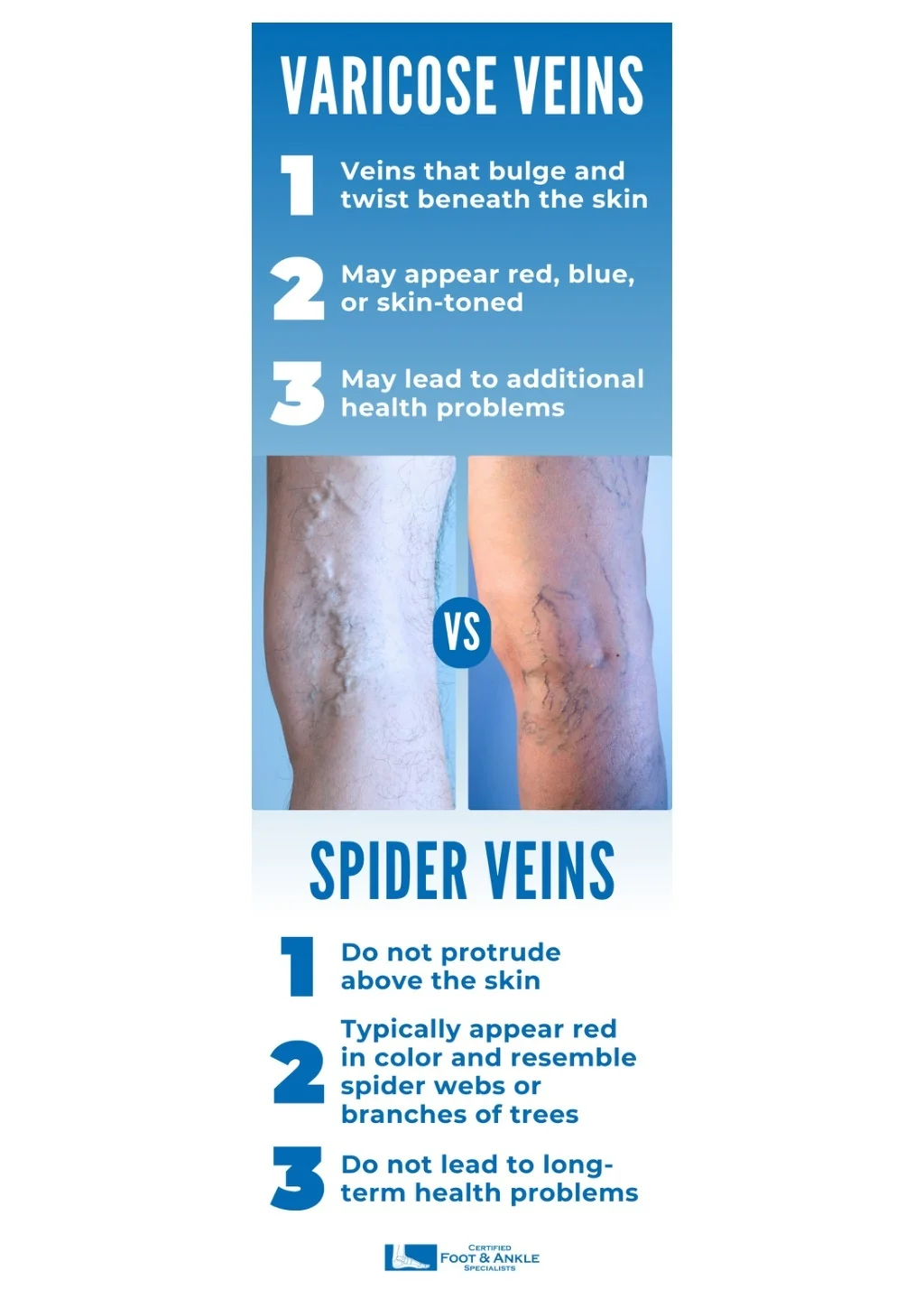 PPT - Understanding the Difference: Varicose Veins vs. Spider Veins ...