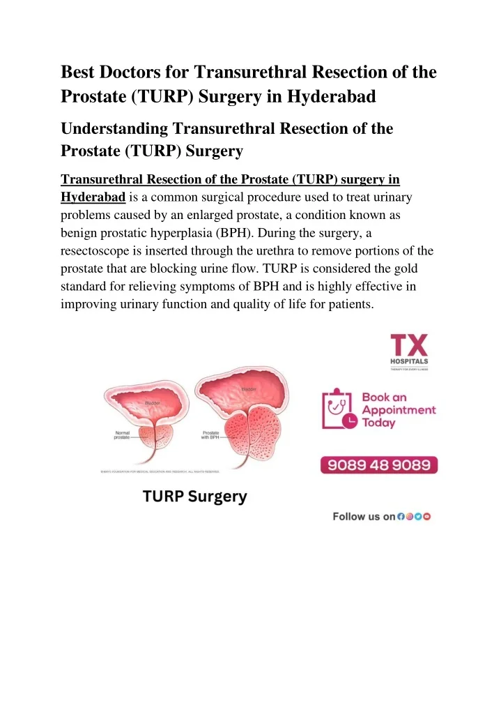 PPT - Best Doctors for TURP Surgery in Hyderabad - TX Hospitals ...
