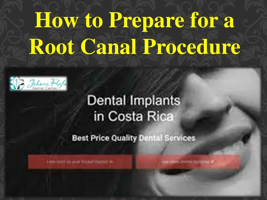 PPT - How to Prepare for a Root Canal Procedure PowerPoint Presentation ...