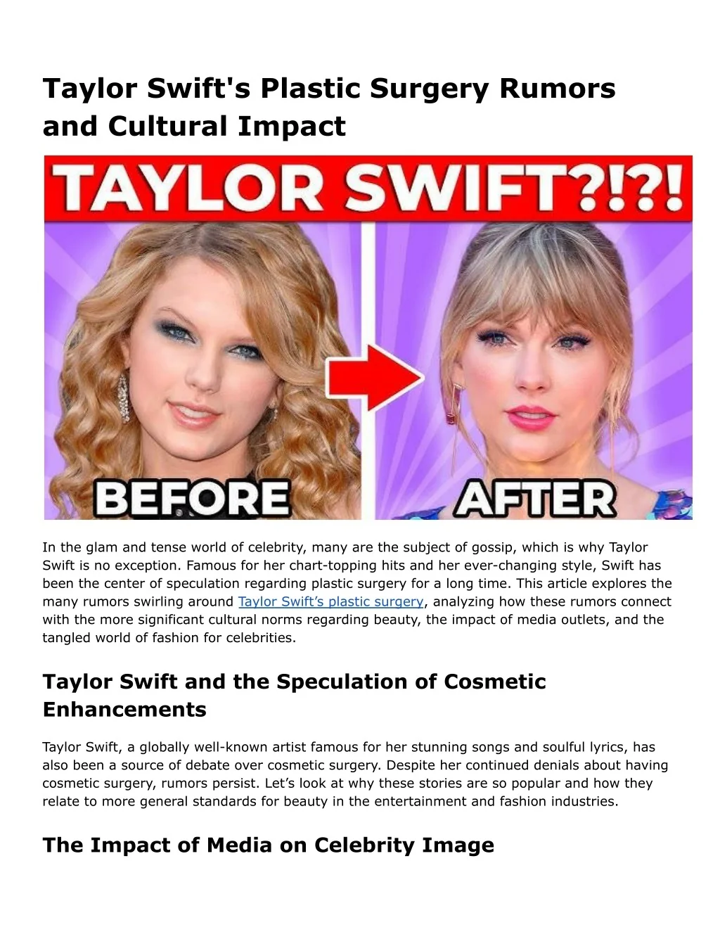 PPT - Taylor Swift’s Plastic Surgery Rumors PowerPoint Presentation ...