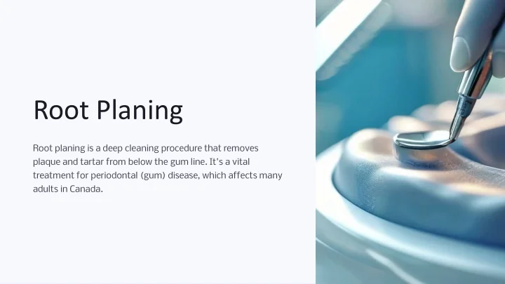 PPT - Root-Planing Treatment Richmond PowerPoint Presentation, free ...