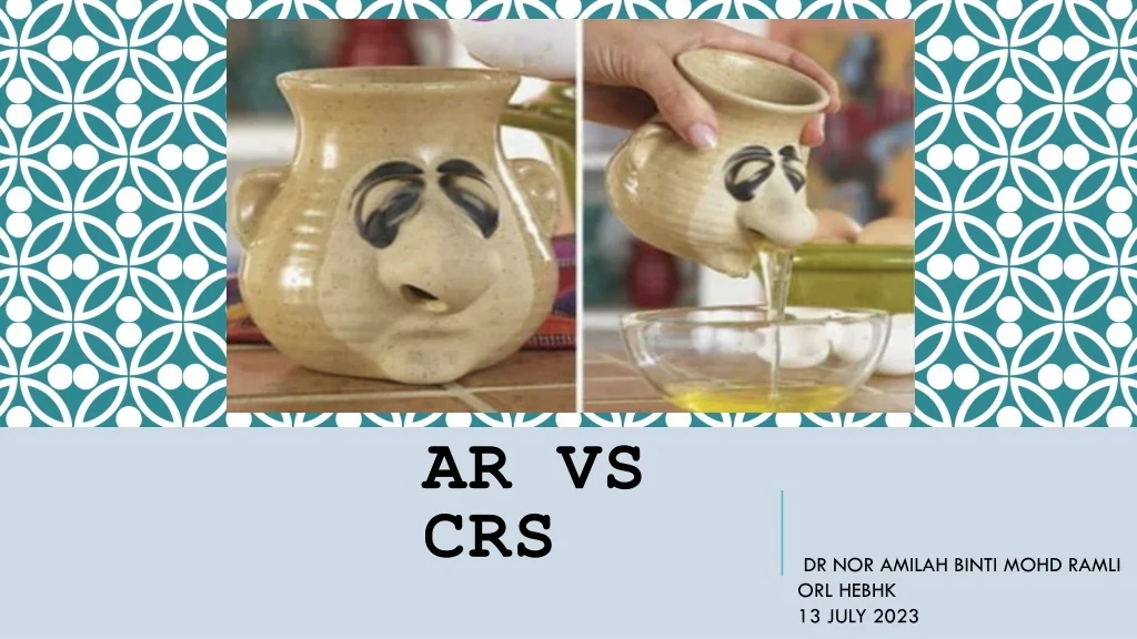 PPT - AR VS CRS PowerPoint Presentation, free download - ID:13508193