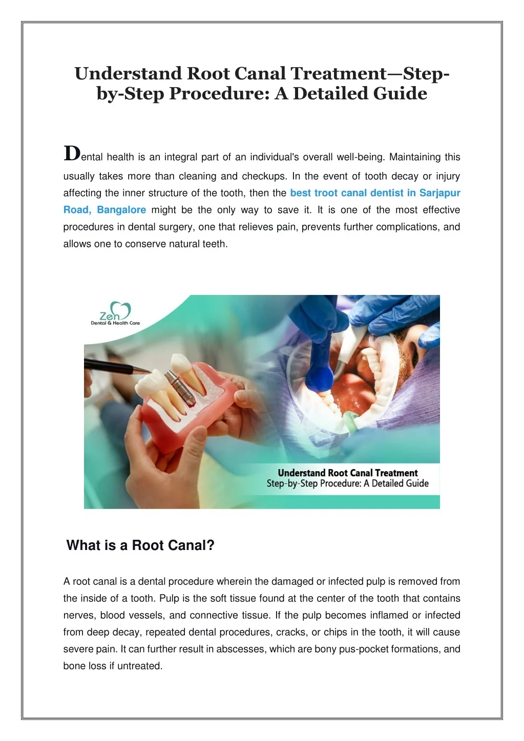 PPT - Understand Root Canal Treatment—Step-by-Step Procedure: A ...