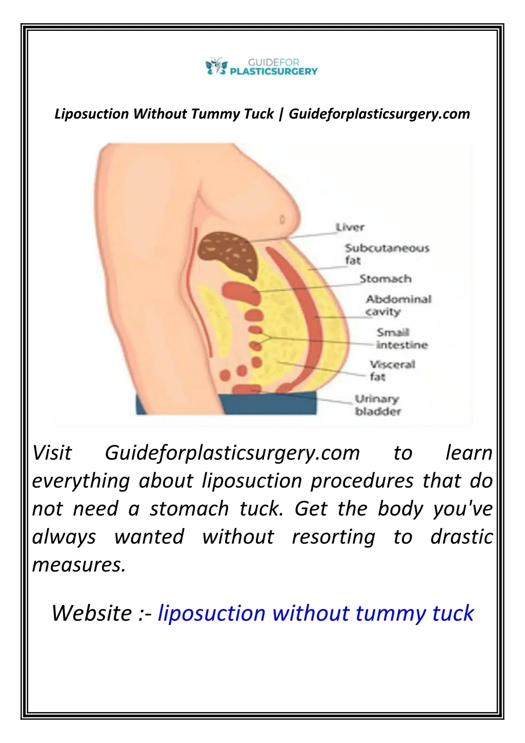 PPT - Liposuction Without Tummy Tuck Guideforplasticsurgery.com ...